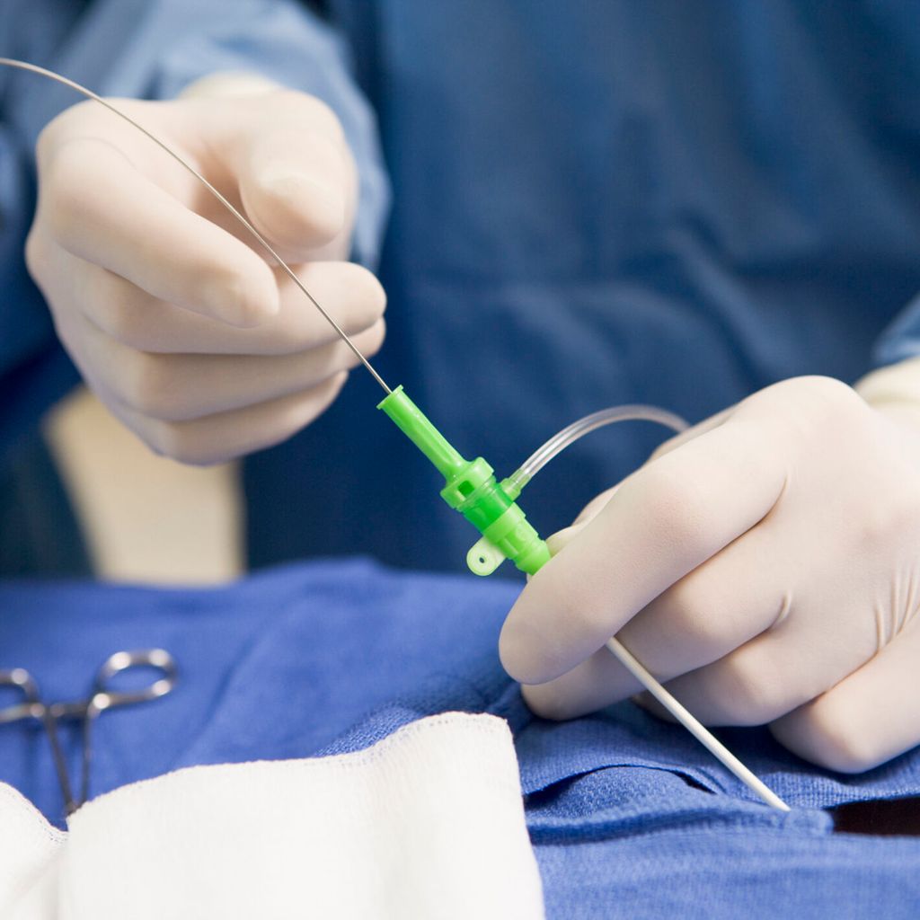 hohes-blutungsrisiko-nach-pci-ein-monat-dapt-ist-genug-kardiologie